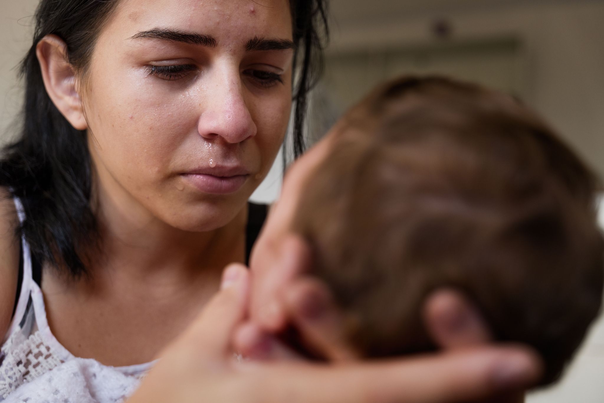 What It’s Like to Raise a Baby With Microcephaly