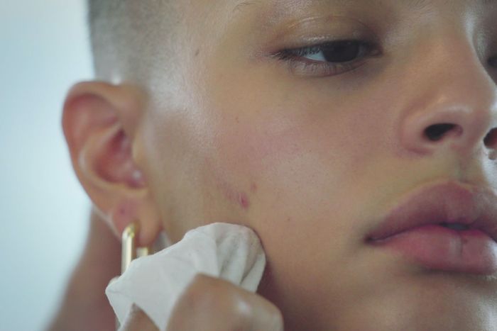 How to Cover Up a Pimple With Makeup (Video Tutorial)