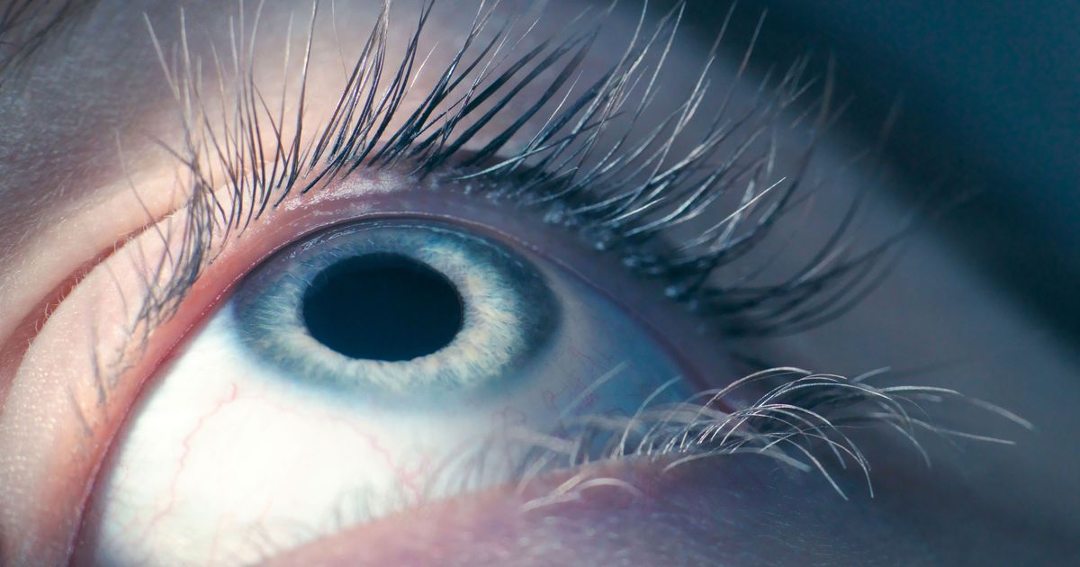 What Causes Eye Floaters?