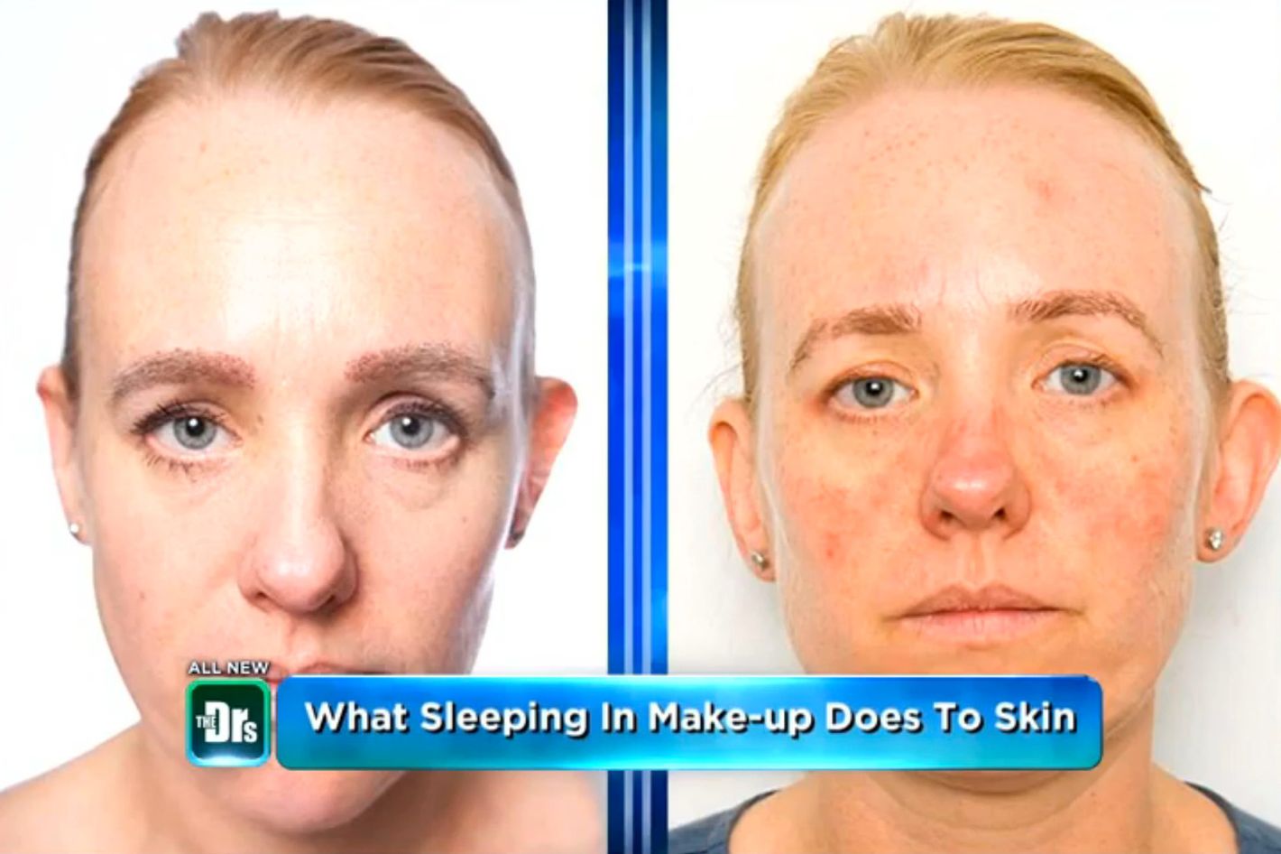 What 30 Days of Unwashed Face Looks Like