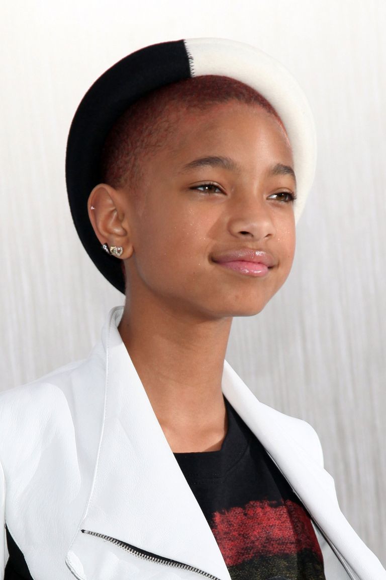 A Brief History of Famous Women Going Bald
