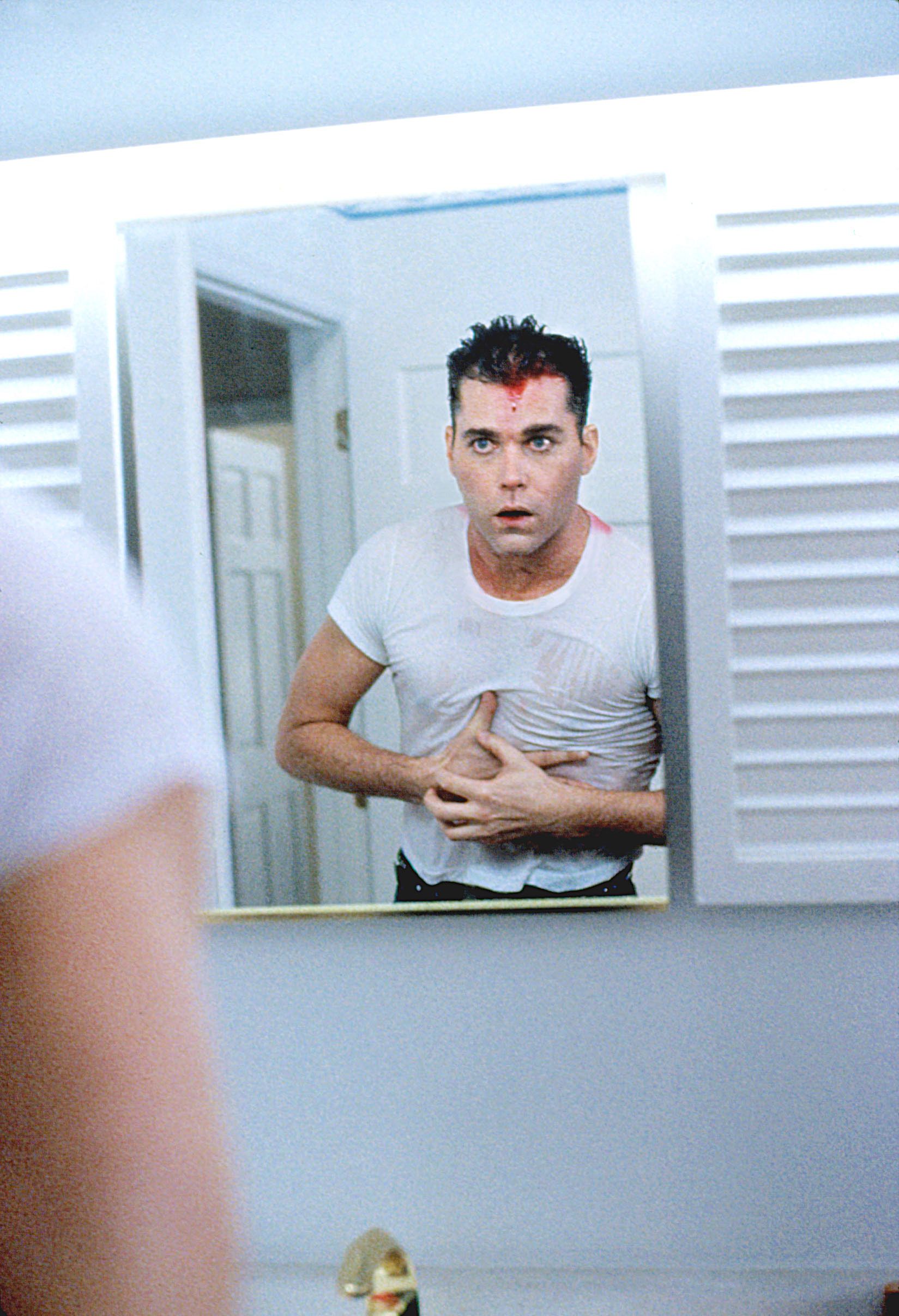 Ray Liotta Acne Scars