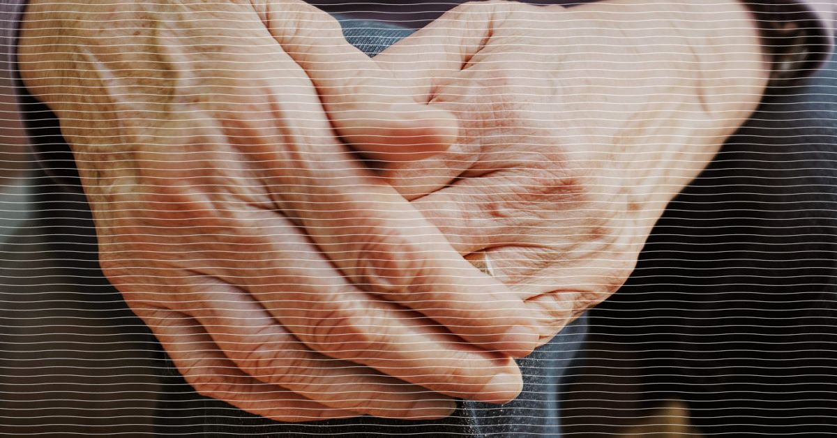 Why Are My Hands Ugly?