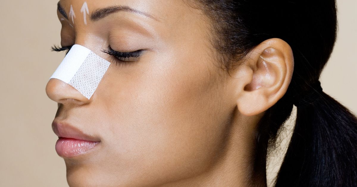 Temporary Nose Jobs are Cheap, Easy, Potentially Dangerous
