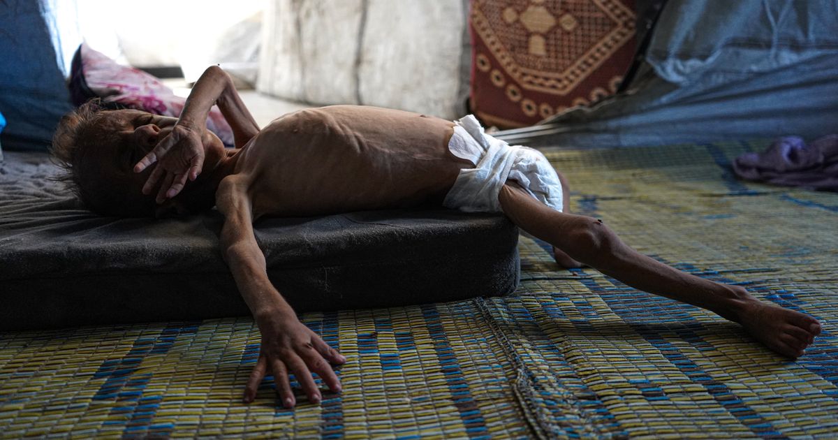How Many Dead Children Does It Take to Oppose Israel’s War?