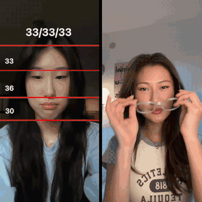 Are You Worried About Having a Long Midface?