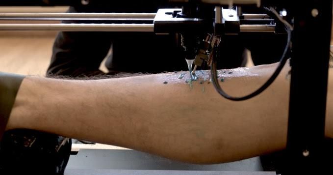 This Robot Can Give You a Hyperaccurate Tattoo