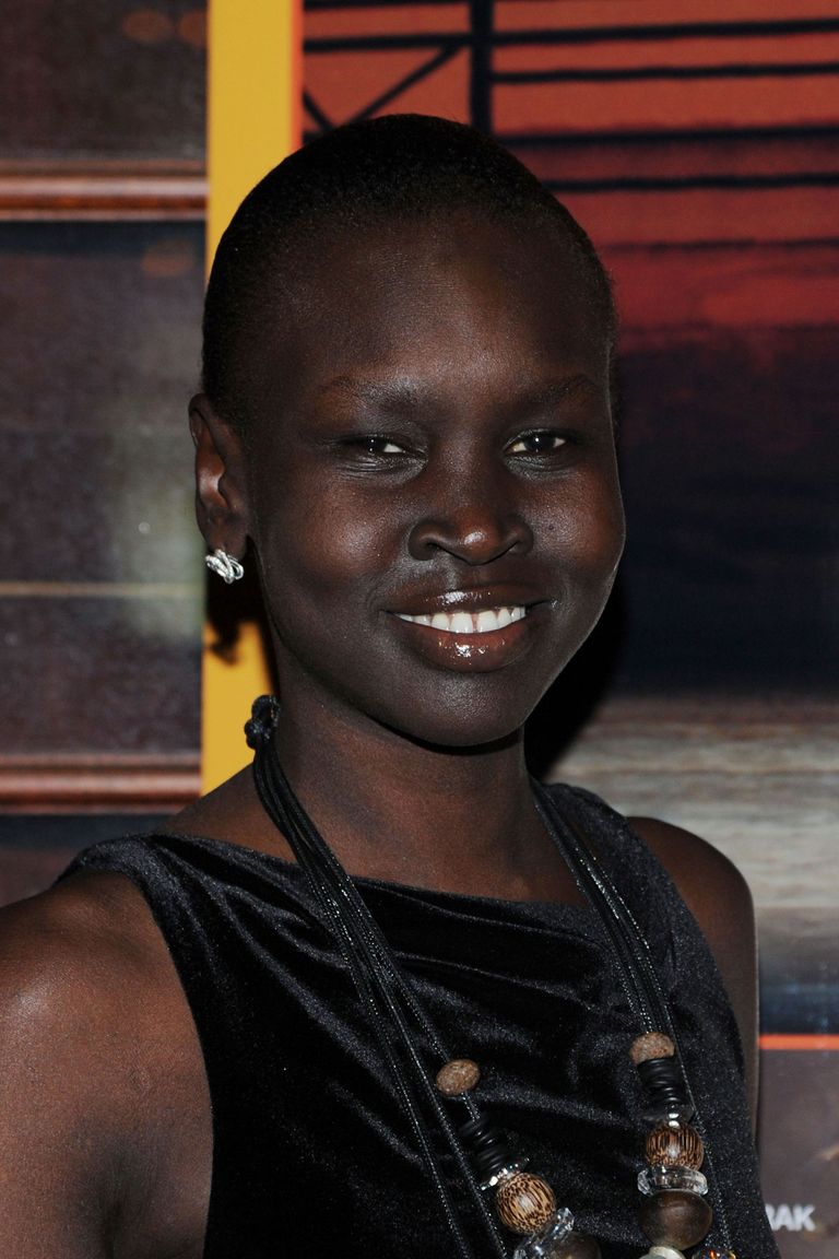 A Brief History of Famous Women Going Bald