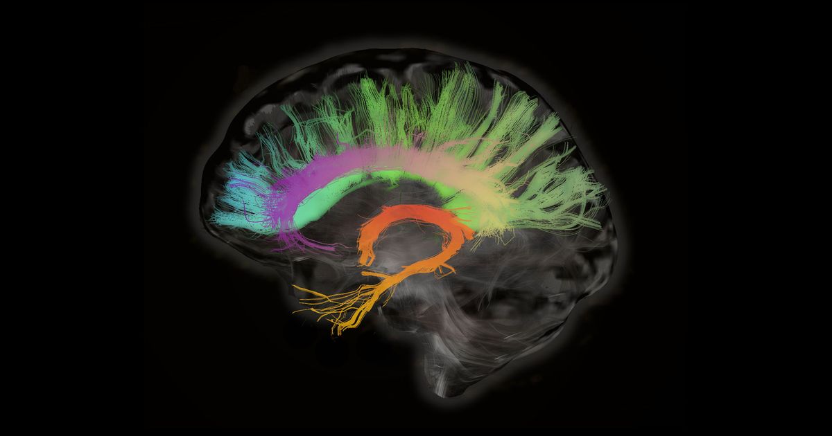 A Study Shows Promise for Future Alzheimer's Treatments -- Science of Us