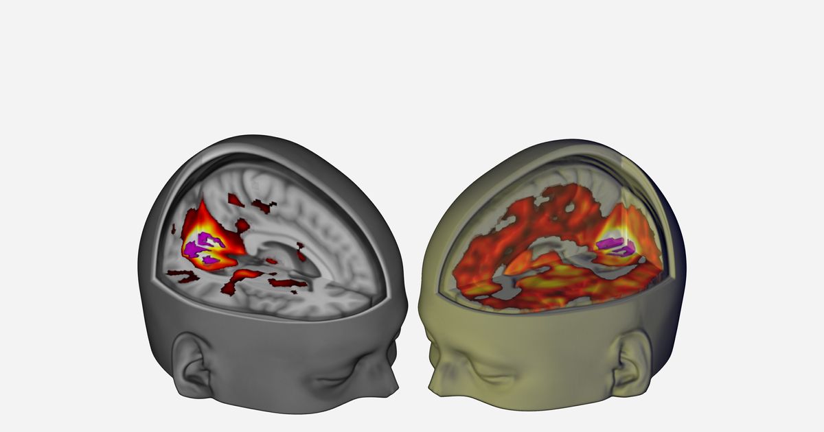 Trippy Images Show What Brains on LSD Look Like -- Science of Us