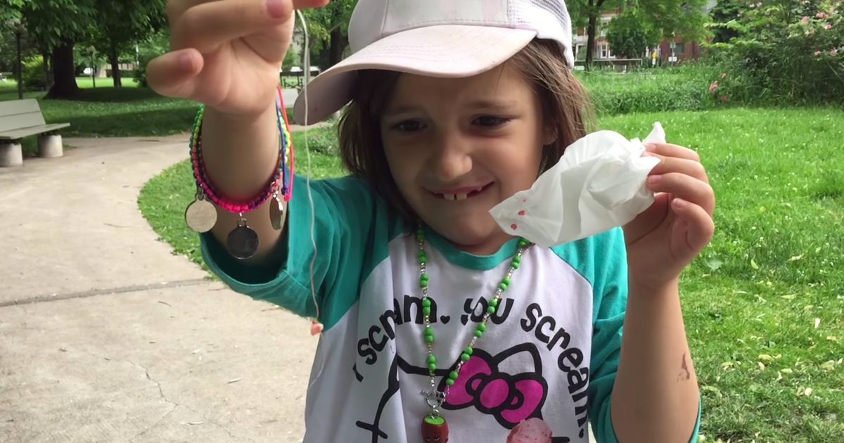 Squirrel Pulls Tooth from Girl in Park