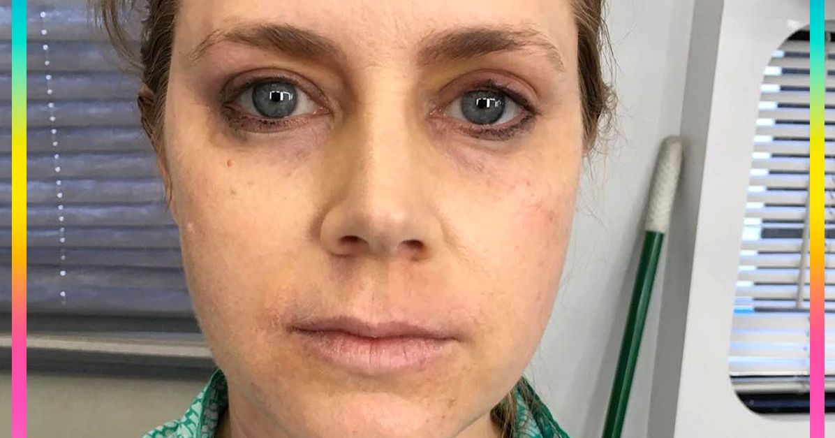 Interview: HBO Sharp Objects Makeup Artist