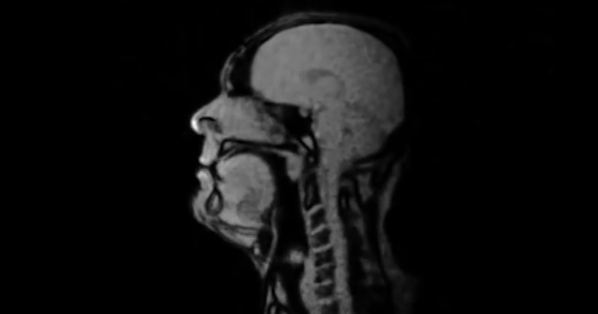 MRI Shows An Opera Singer Performing -- Science of Us