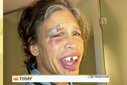 See Steven Tyler's New Face