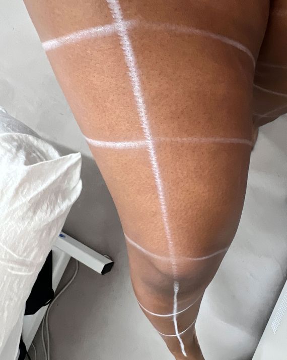 Would You Spend $3,123 to Never Shave Again?