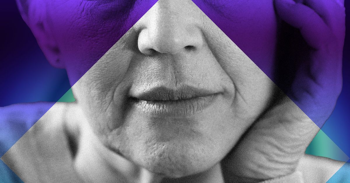 What To Do About Marionette Lines: Surgery and Nonsurgical