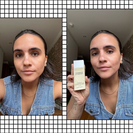 The Incels Getting Extreme Plastic Surgery to Become ‘Chads’