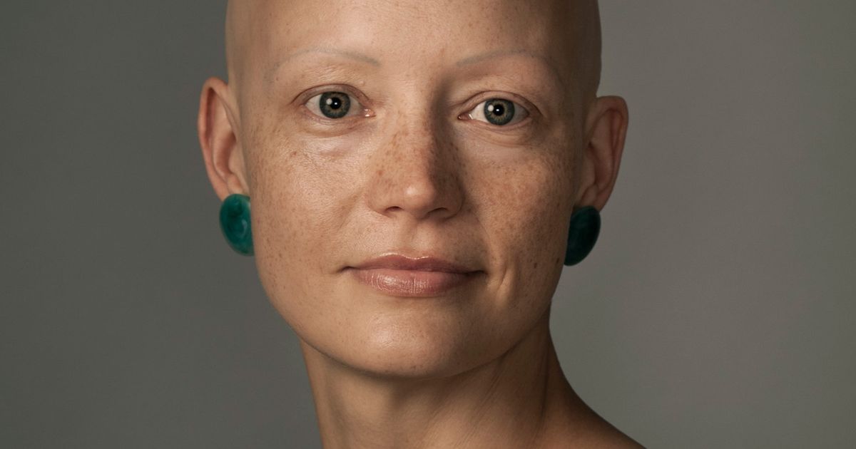 Helen Phillips ‘The Need’ Profile