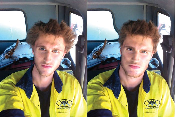 The Incels Getting Extreme Plastic Surgery to Become ‘Chads’