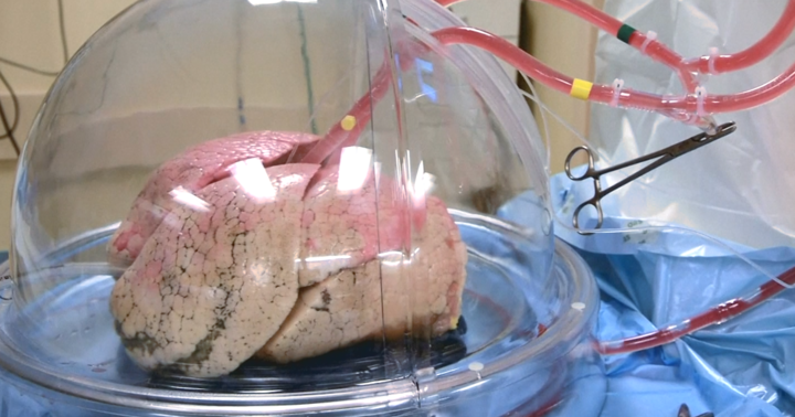 Device Allows Lungs to Stay Alive After Removed -- Science of Us