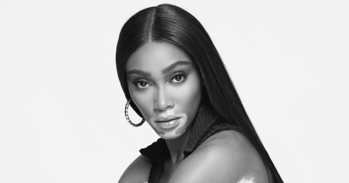 Model Winnie Harlow Is the First-Ever Face of Paul Mitchell