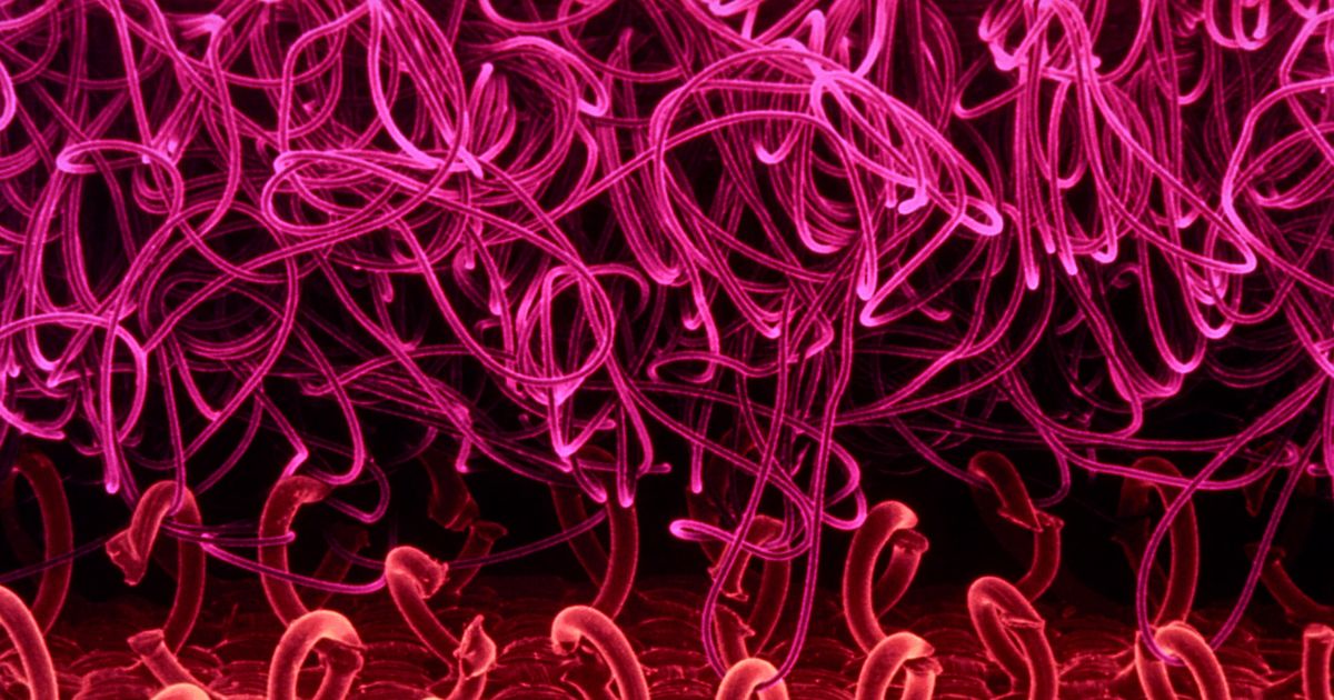 An Idea That Stuck: How George de Mestral Invented Velcro