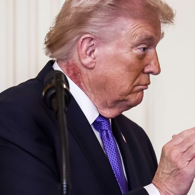President Trump Has a Weird New Rash on His Neck