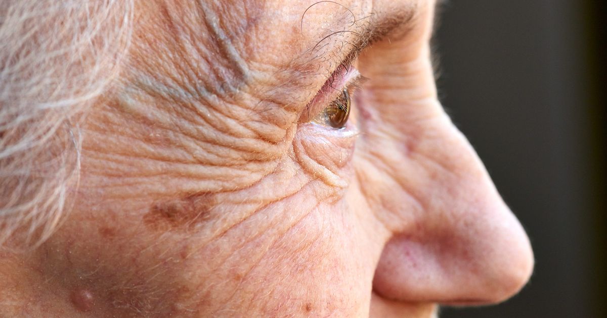 What It’s Like to Live With Early Stage Dementia