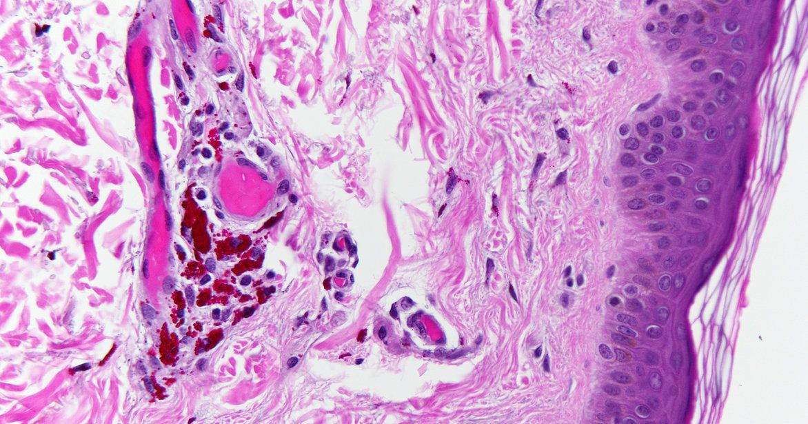 What a Tattoo Looks Like Up Really, Really Close